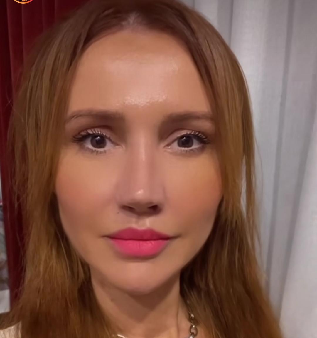 Ivonino iskustvo - četiri operacije do željenog izgleda nosa